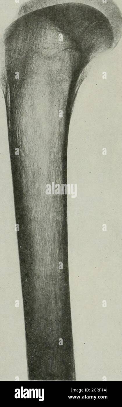 . The American journal of roentgenology, radium therapy and nuclear ...
