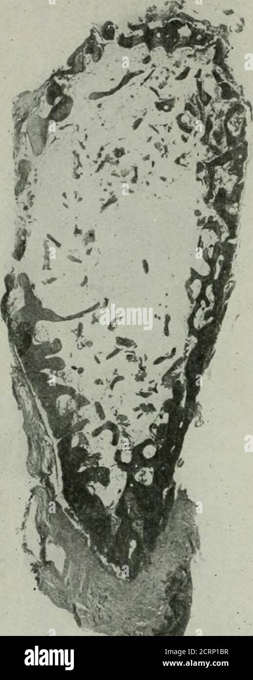 . The American journal of roentgenology, radium therapy and nuclear ...