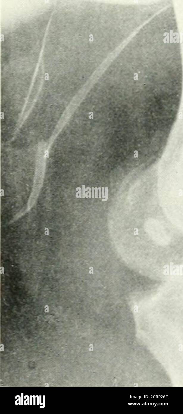 . Radiography, x-ray therapeutics and radium therapy Stock Photo - Alamy