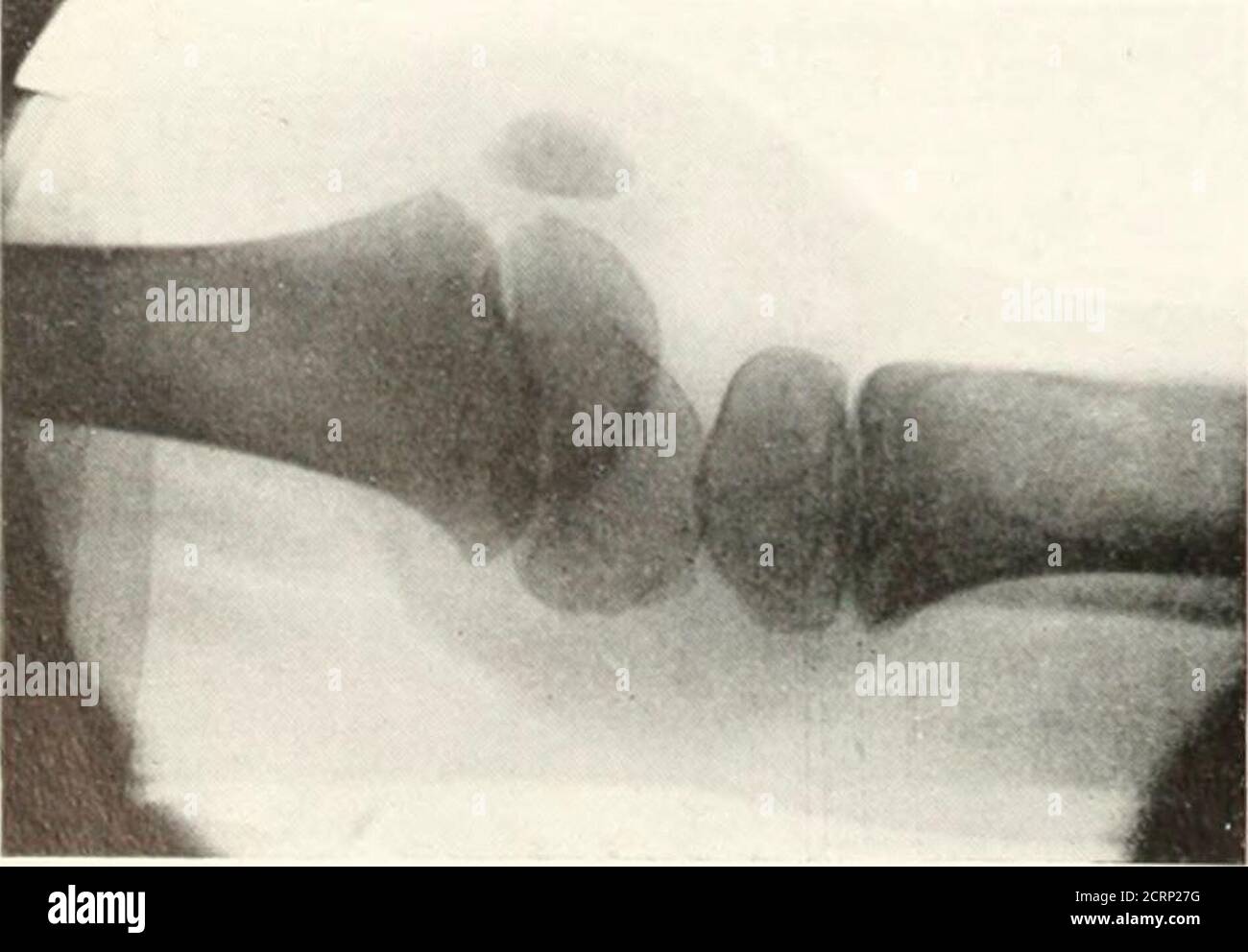 . Radiography, x-ray therapeutics and radium therapy Stock Photo - Alamy