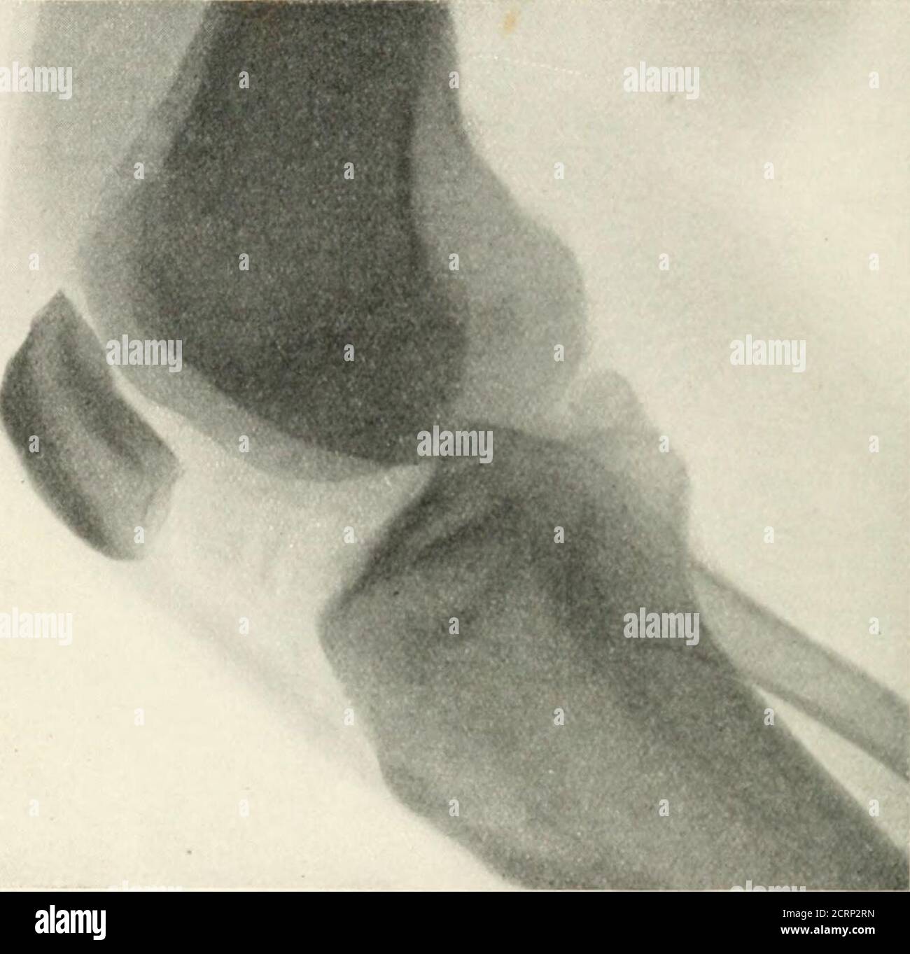 . Radiography, x-ray therapeutics and radium therapy . ease. Insome ...