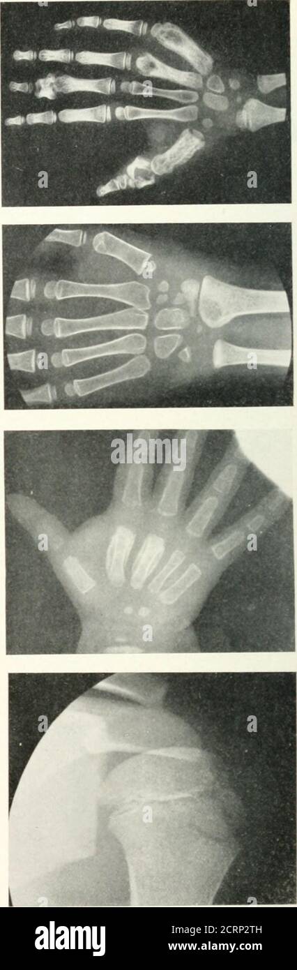 . Radiography, x-ray therapeutics and radium therapy . ^. PLATE XXVI ...