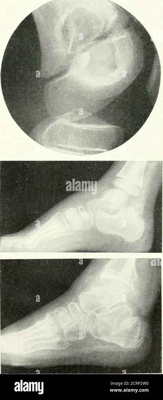 . Radiography, x-ray therapeutics and radium therapy . PLATE XXV ...