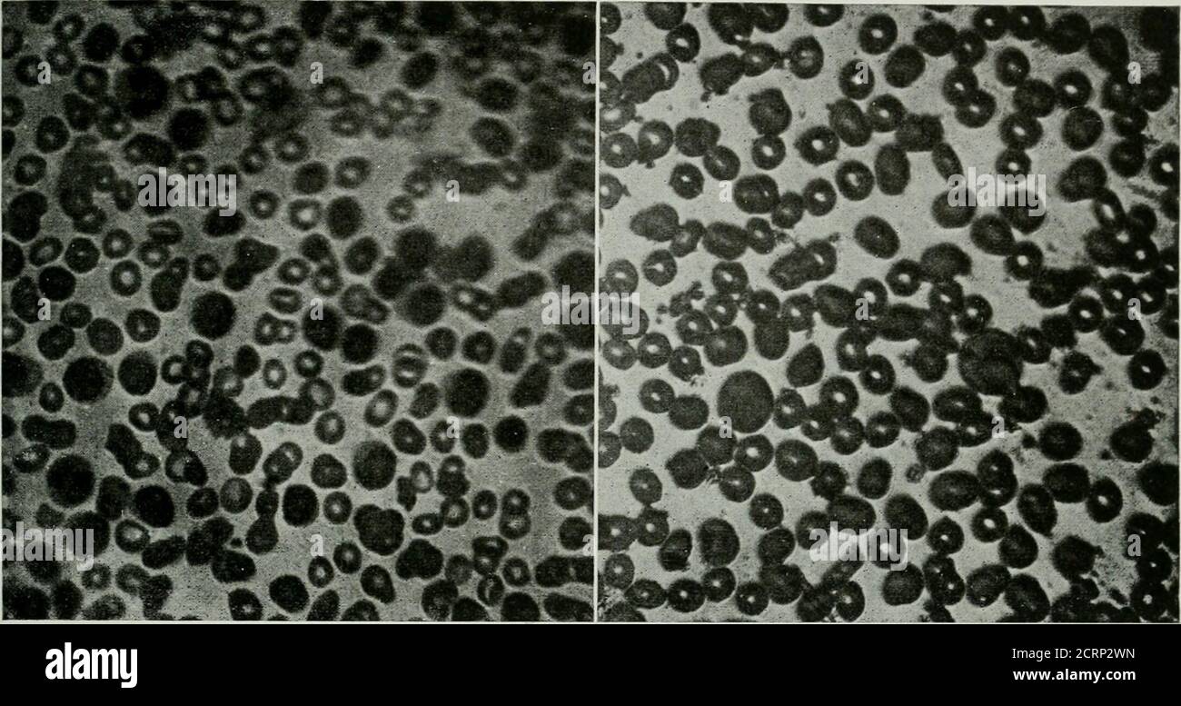 American roentgen ray society hi-res stock photography and images - Alamy