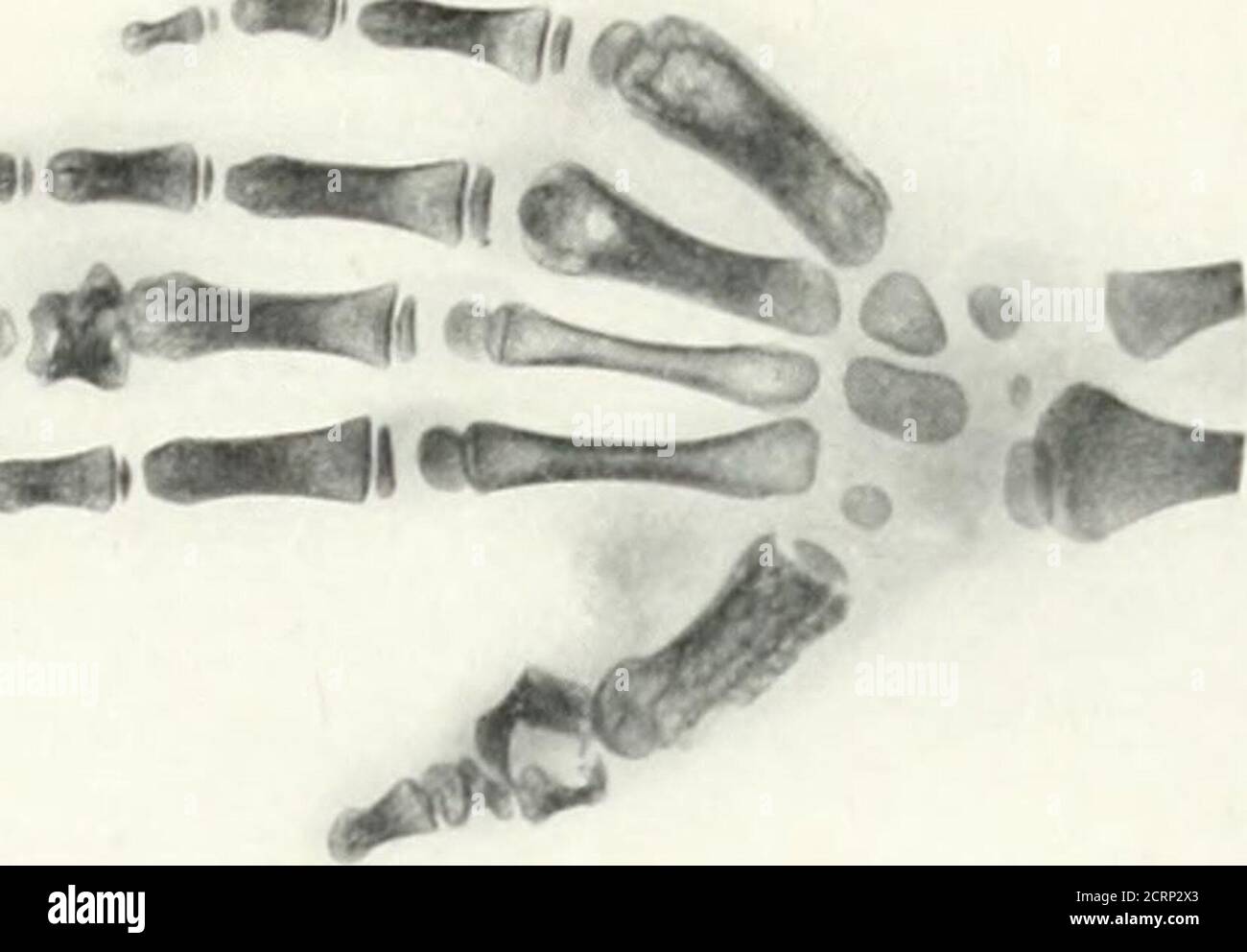 . Radiography, x-ray therapeutics and radium therapy . PLATE XXV ...