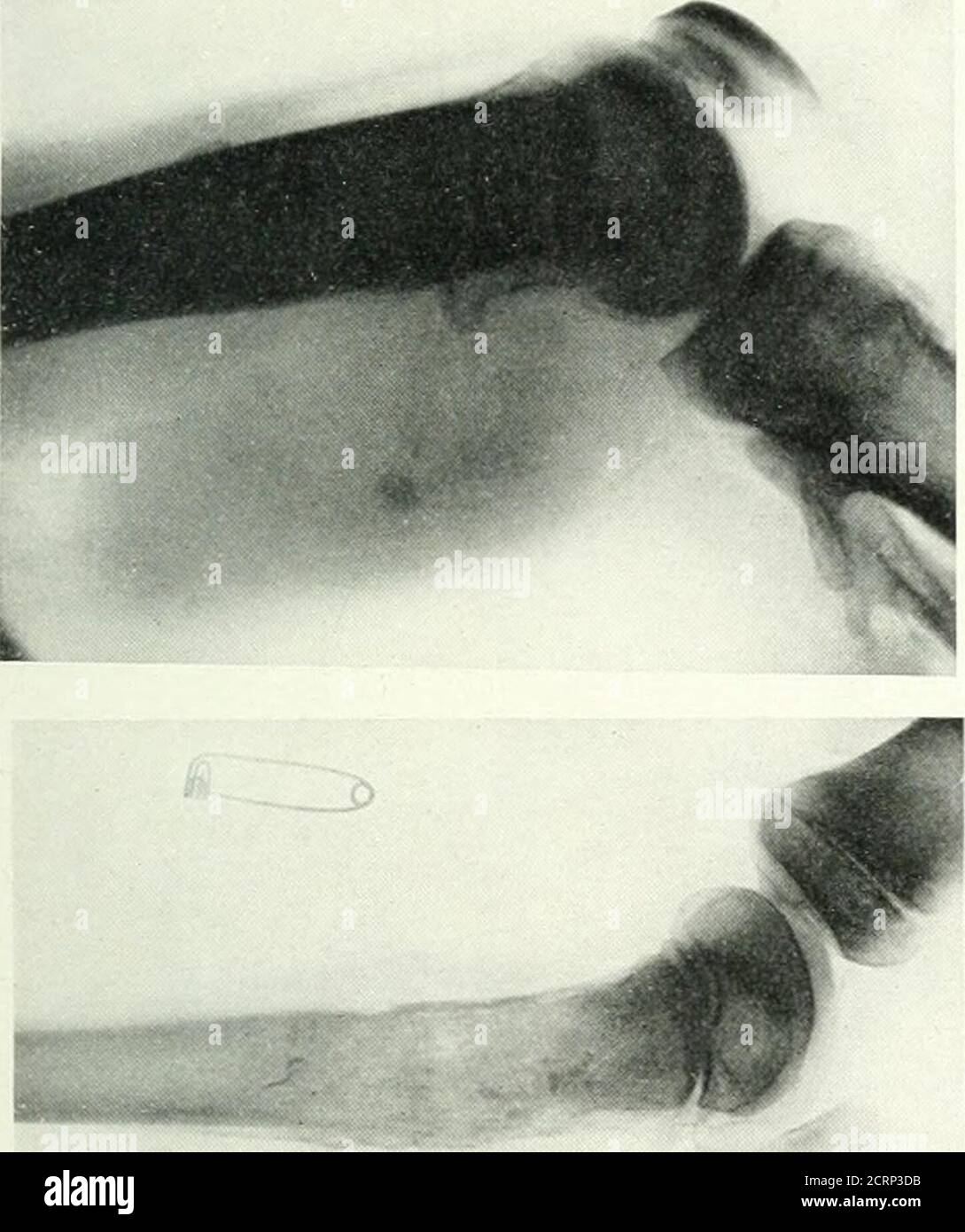 . Radiography, x-ray therapeutics and radium therapy Stock Photo - Alamy