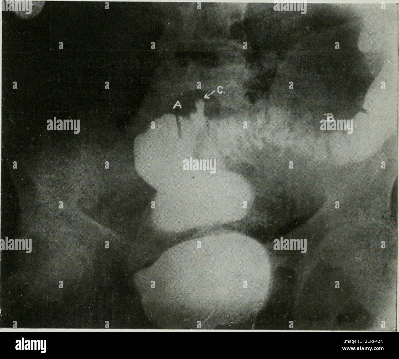 Gastroi hi-res stock photography and images - Alamy