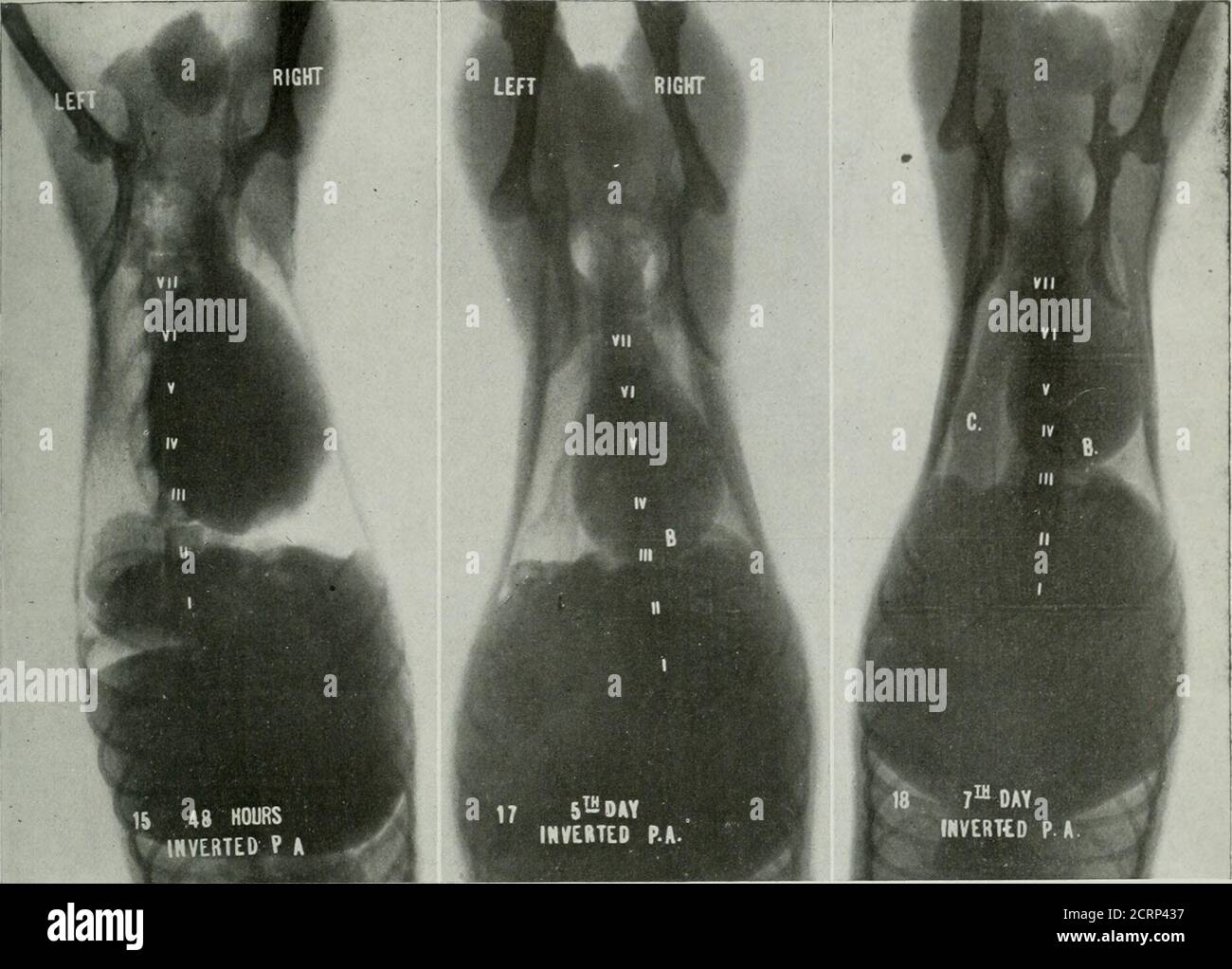 Nuclear medicine injection hi-res stock photography and images - Alamy