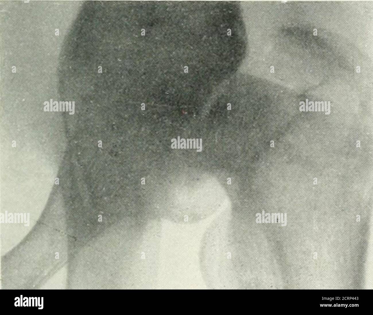 . Radiography, x-ray therapeutics and radium therapy Stock Photo - Alamy