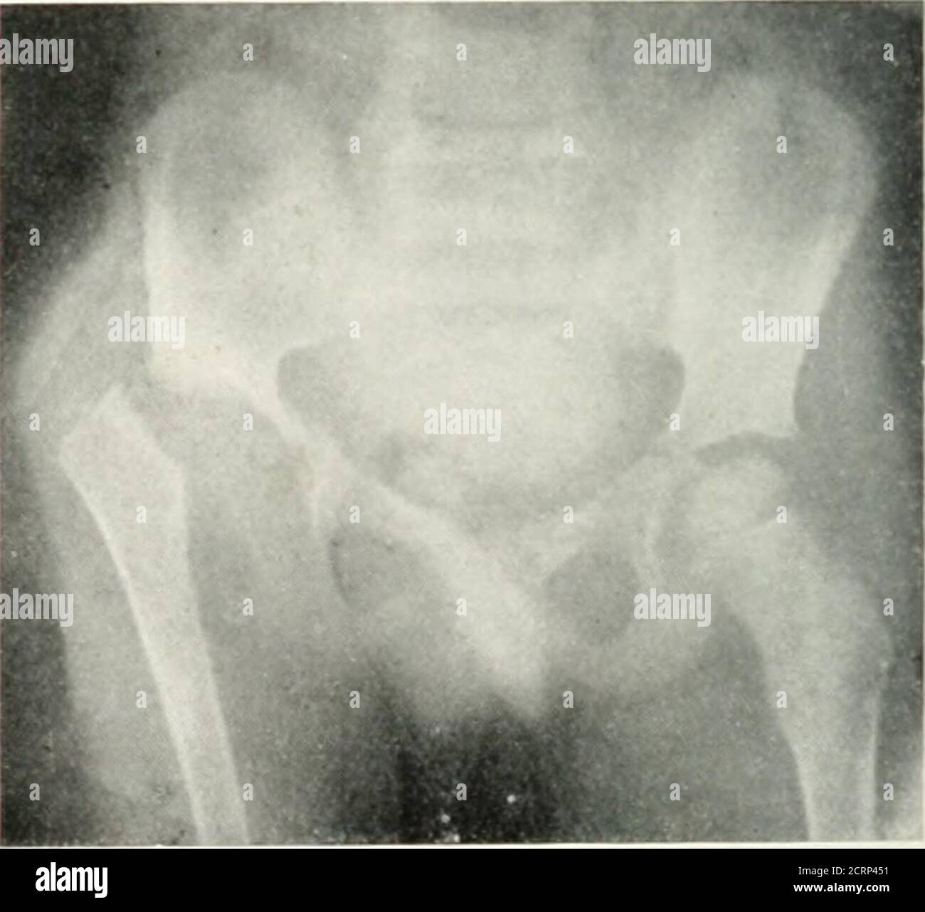 . Radiography, x-ray therapeutics and radium therapy . PLATE XVII ...