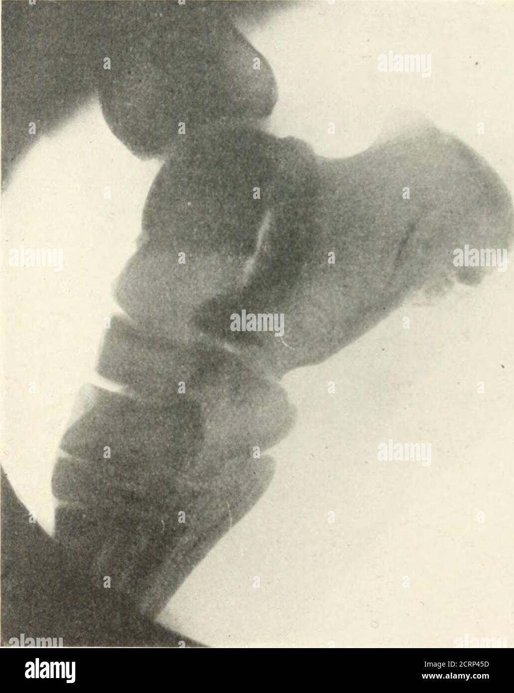 . Radiography, x-ray therapeutics and radium therapy . of direct ...