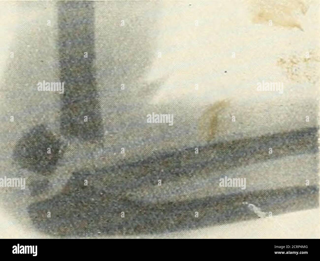 . Radiography, x-ray therapeutics and radium therapy . Fig. 133 ...