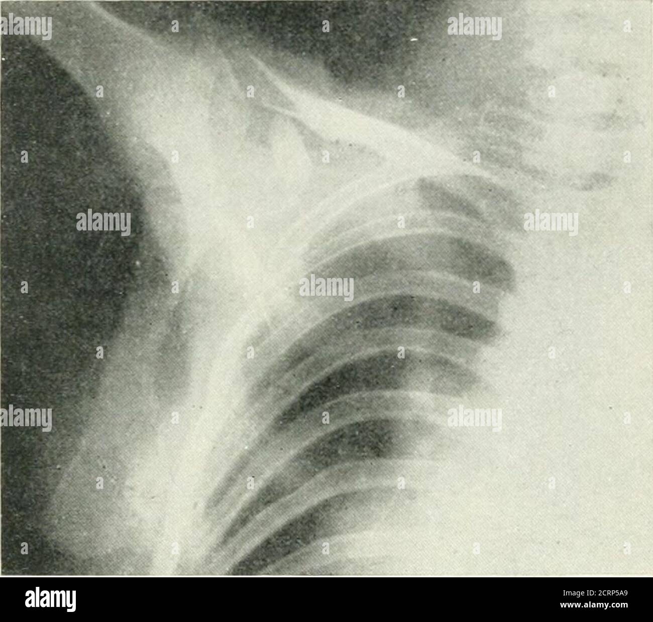 . Radiography, x-ray therapeutics and radium therapy Stock Photo - Alamy