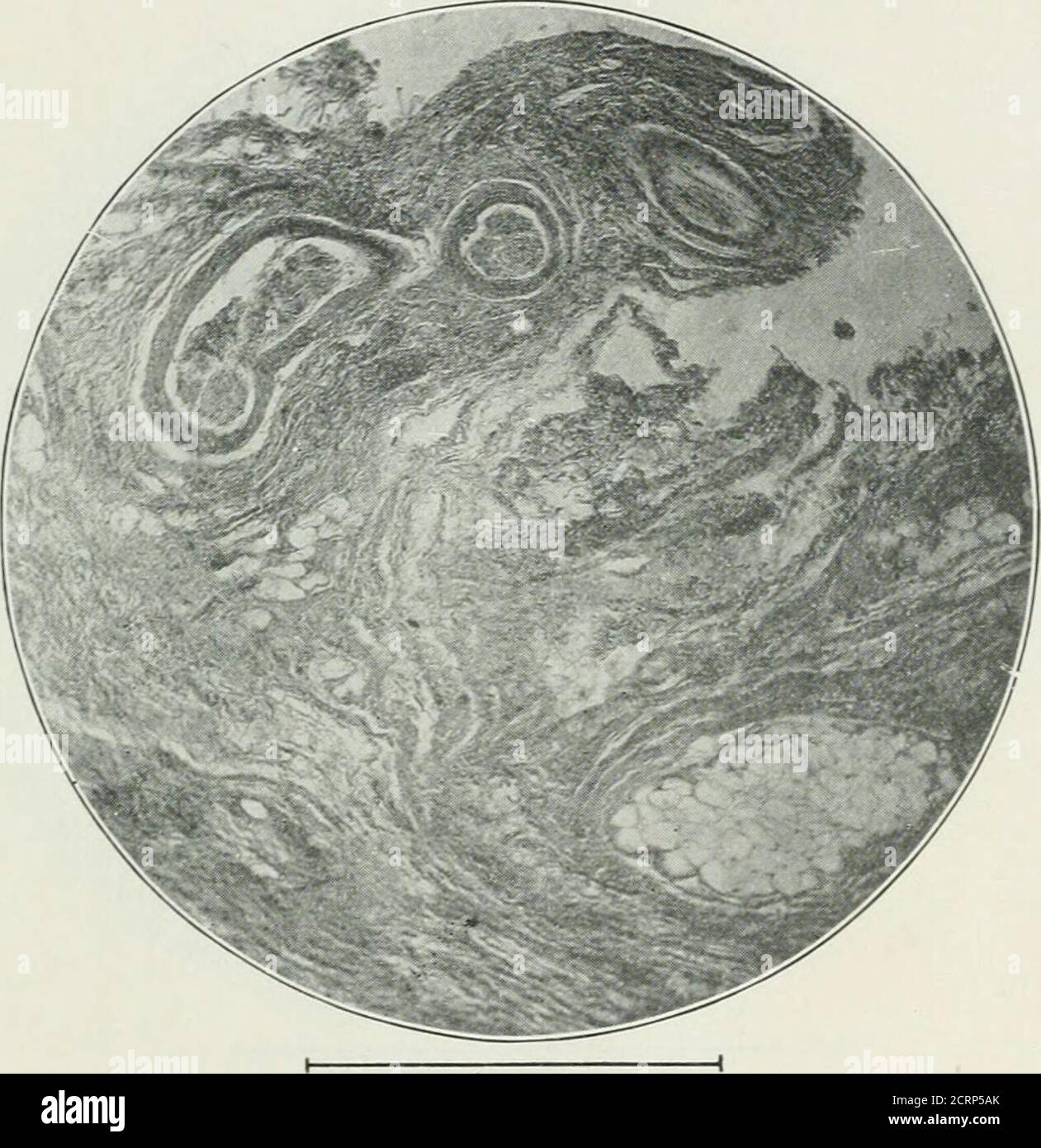 . Radium . d in an oil-immersion field. The epithelial new growth ...