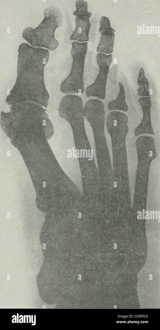 . The American journal of roentgenology, radium therapy and nuclear ...