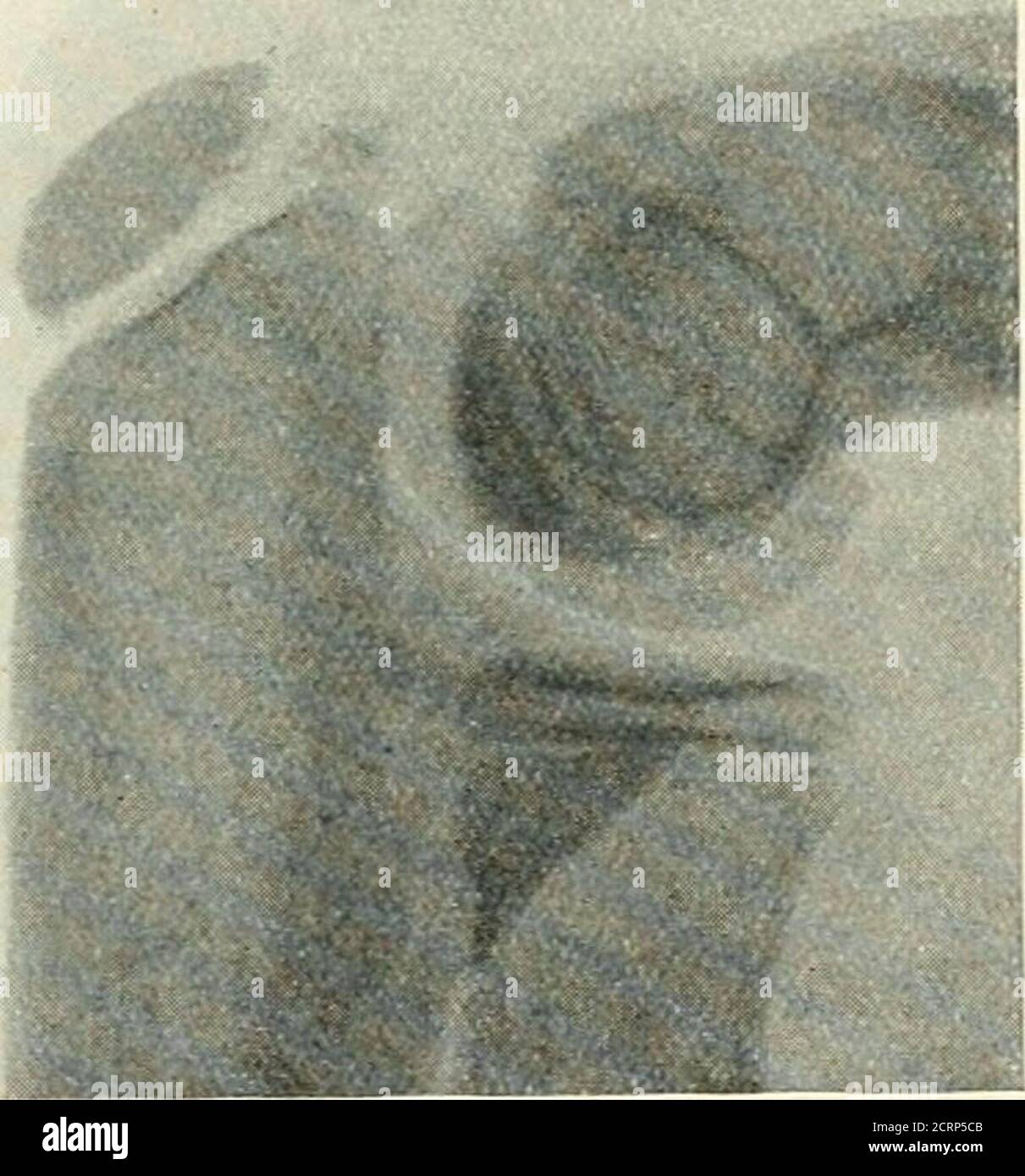 . Radiography, x-ray therapeutics and radium therapy . L 1 Fig. 123 ...