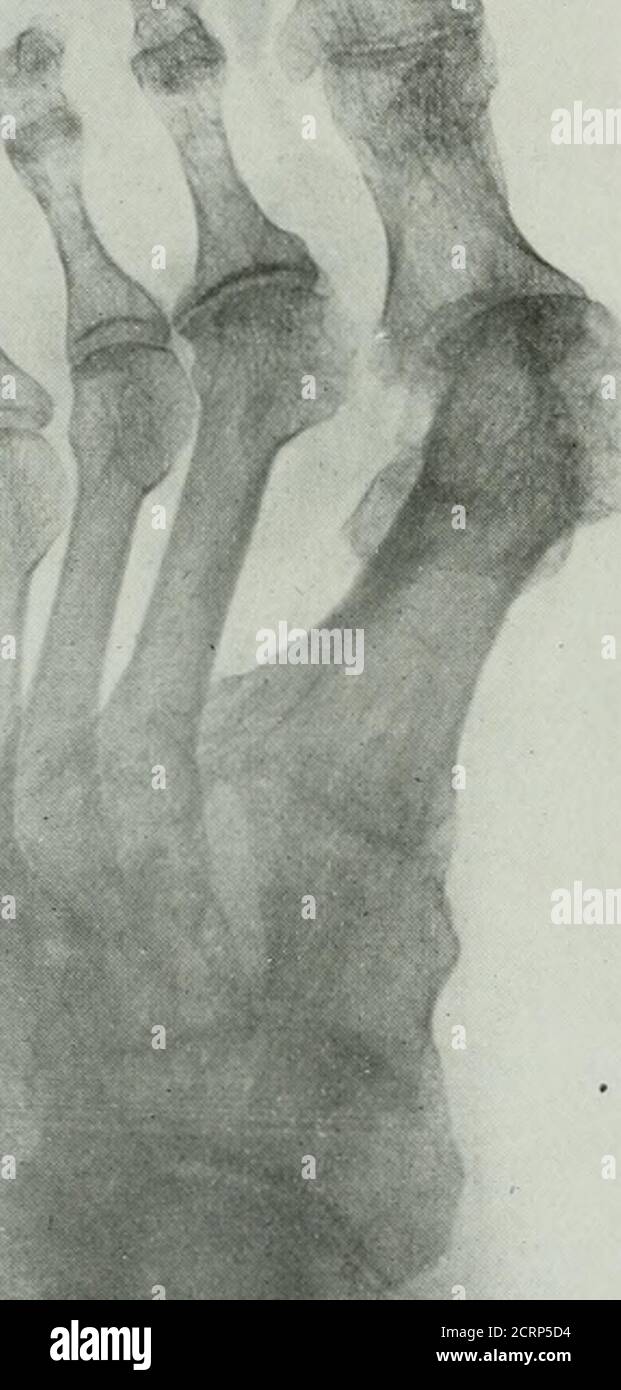 . The American journal of roentgenology, radium therapy and nuclear ...