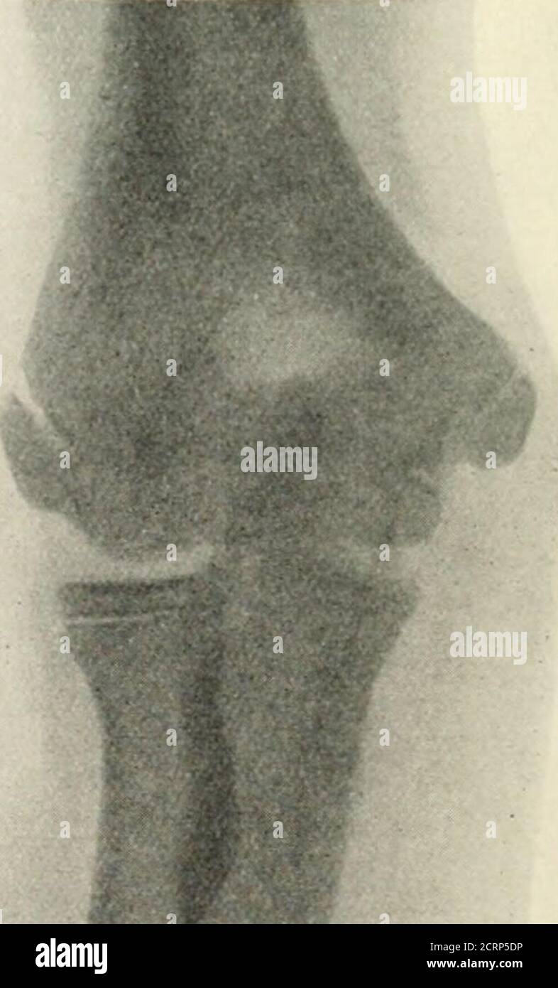 . Radiography, x-ray therapeutics and radium therapy . L 1 Fig. 123 ...