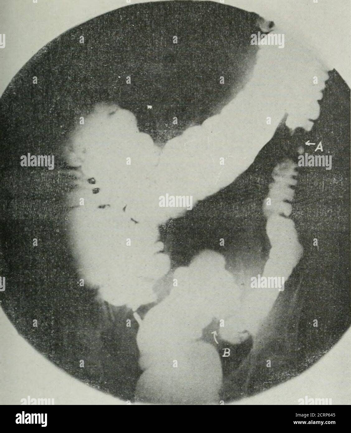 . The American journal of roentgenology, radium therapy and nuclear ...
