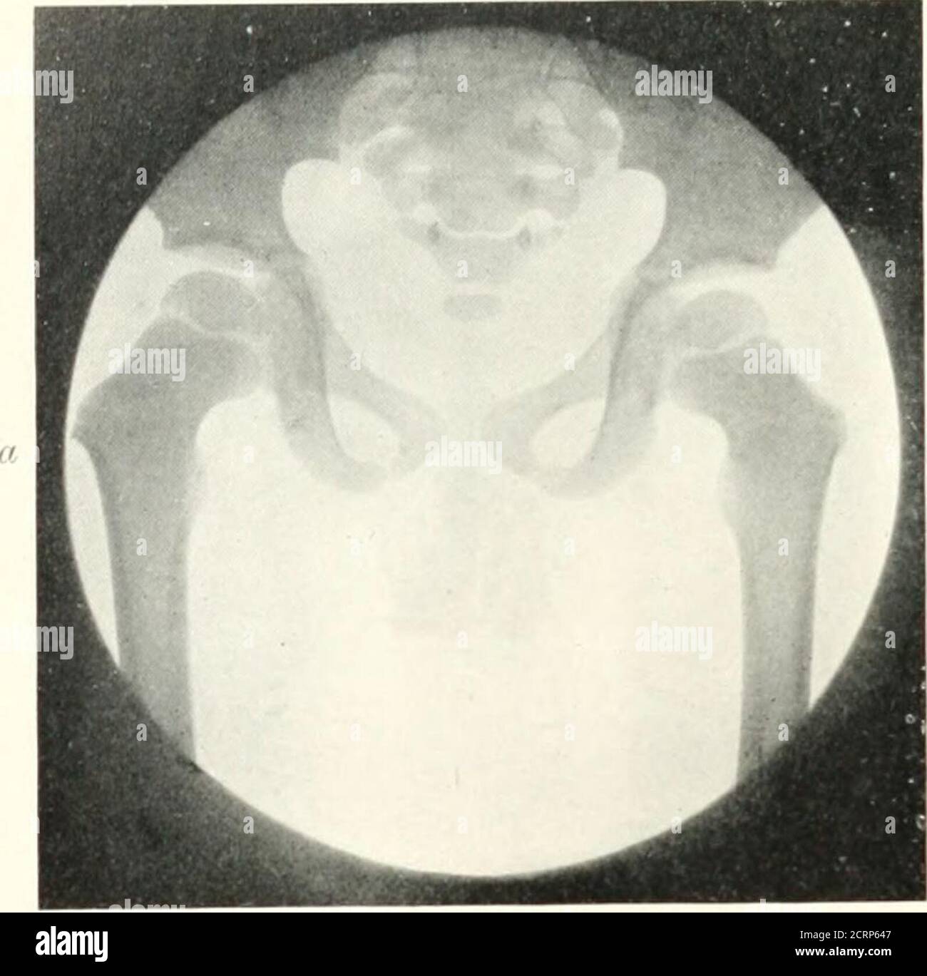 . Radiography, x-ray therapeutics and radium therapy . Fig. 115 ...