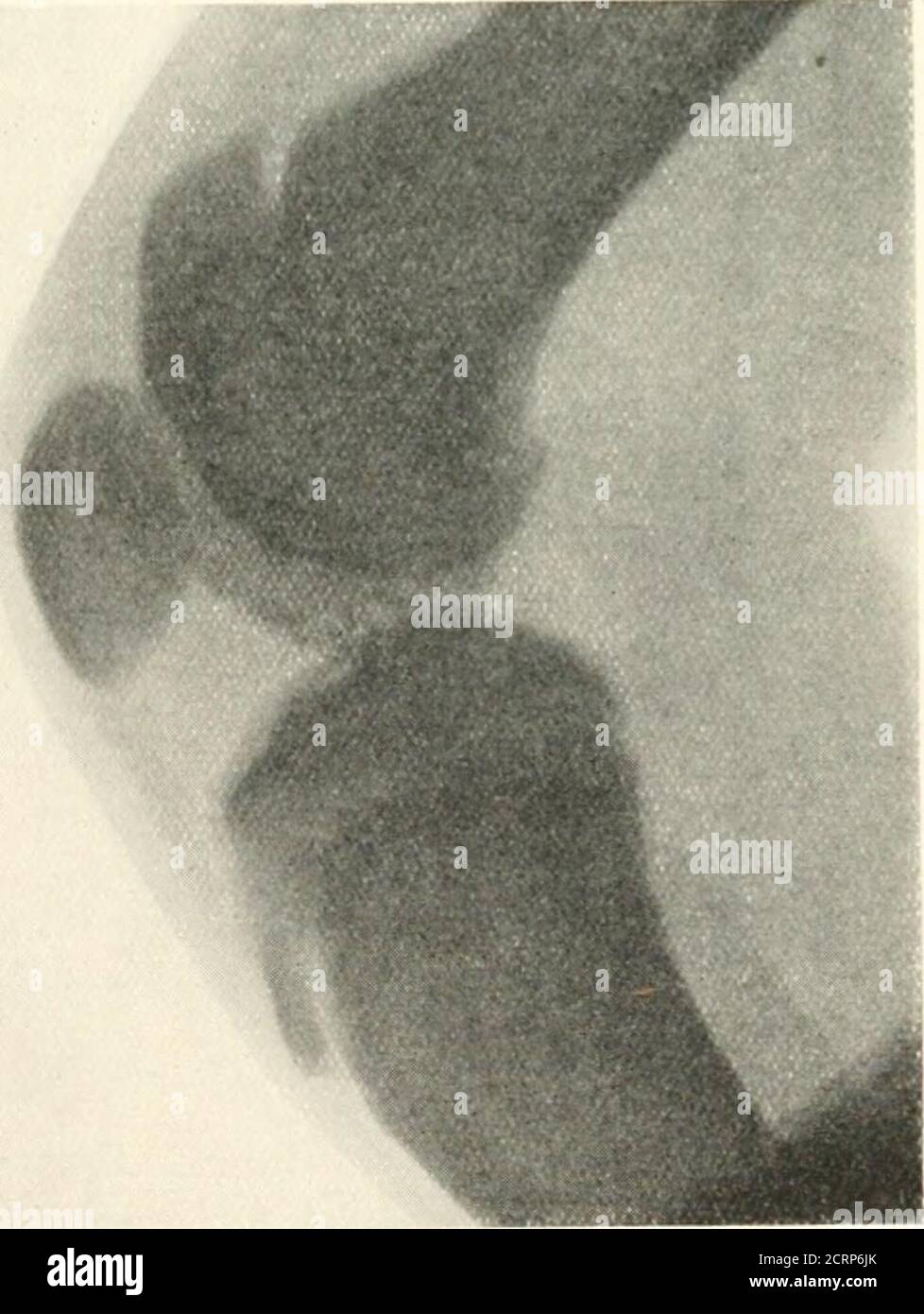 . Radiography, x-ray therapeutics and radium therapy . Antero-posterior ...