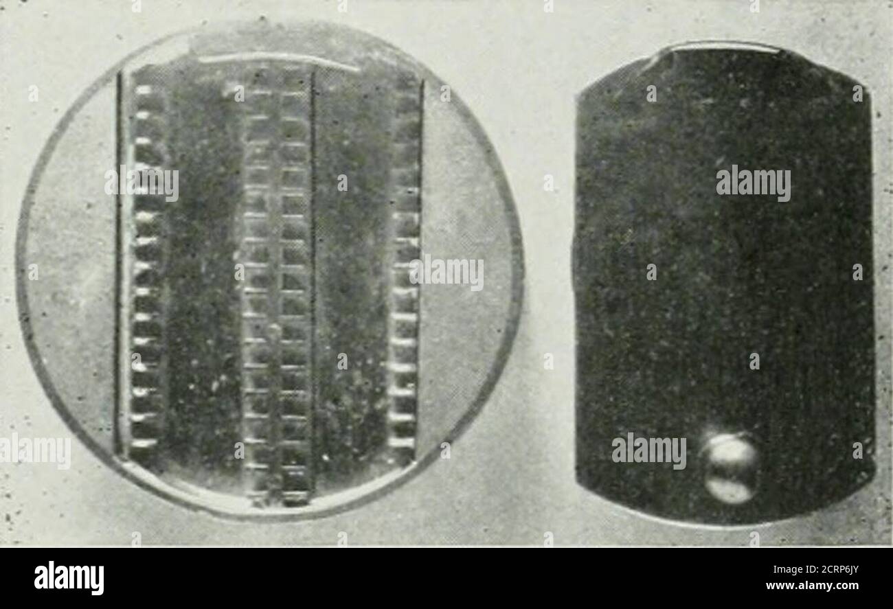 Pharyngotomy hi-res stock photography and images - Alamy