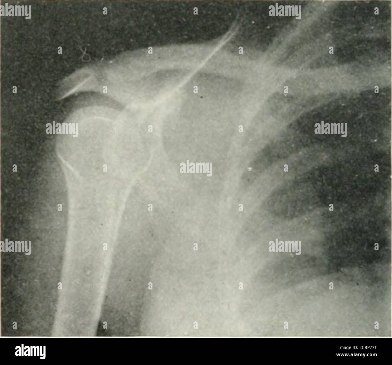 Radium therapy hi-res stock photography and images - Alamy