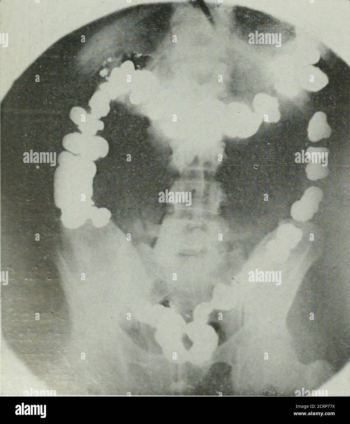 Obliterated tents hi-res stock photography and images - Alamy