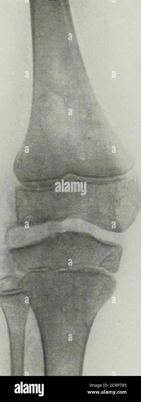 . Living anatomy and pathology; the diagnosis of diseases in early life ...