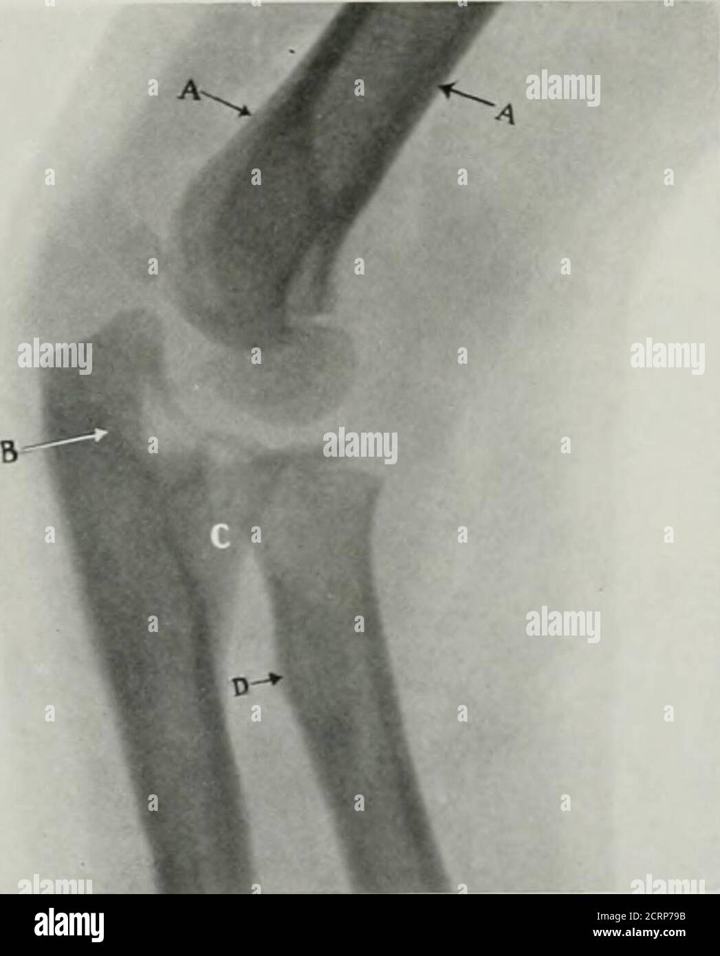 . Living anatomy and pathology; the diagnosis of diseases in early life ...