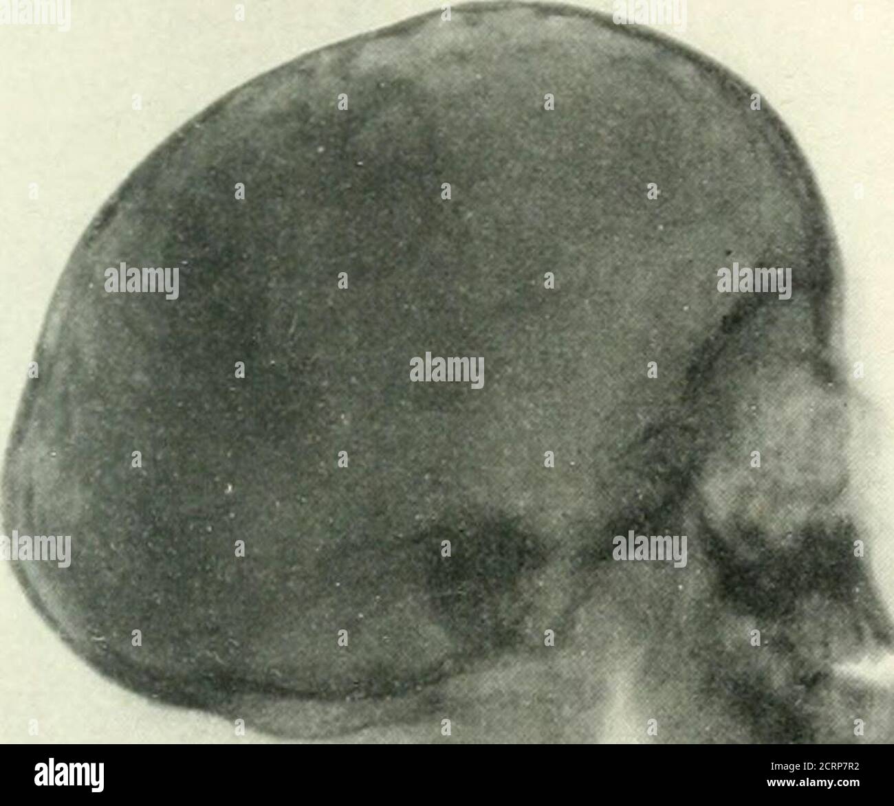 . Radiography, x-ray therapeutics and radium therapy Stock Photo - Alamy