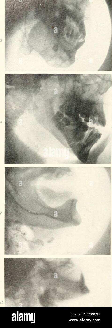 . Radiography, x-ray therapeutics and radium therapy . PLATE III ...