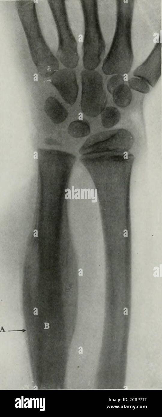 . Living anatomy and pathology; the diagnosis of diseases in early life ...