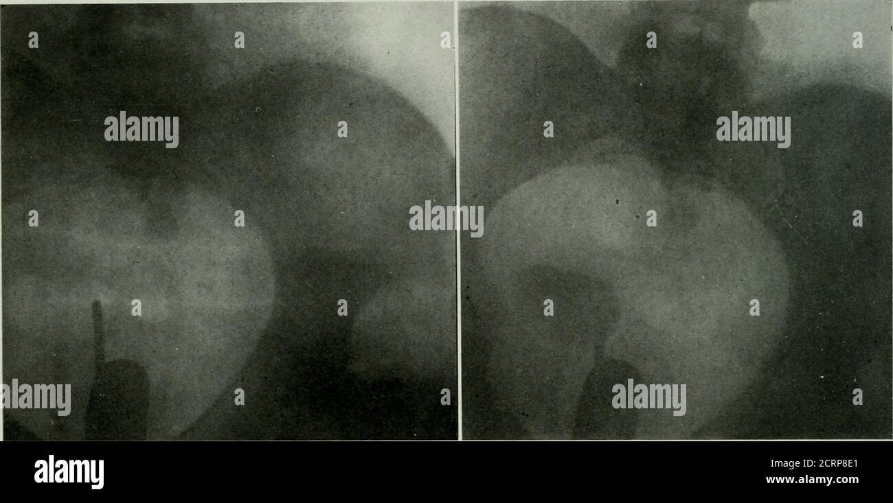 . The American journal of roentgenology, radium therapy and nuclear ...