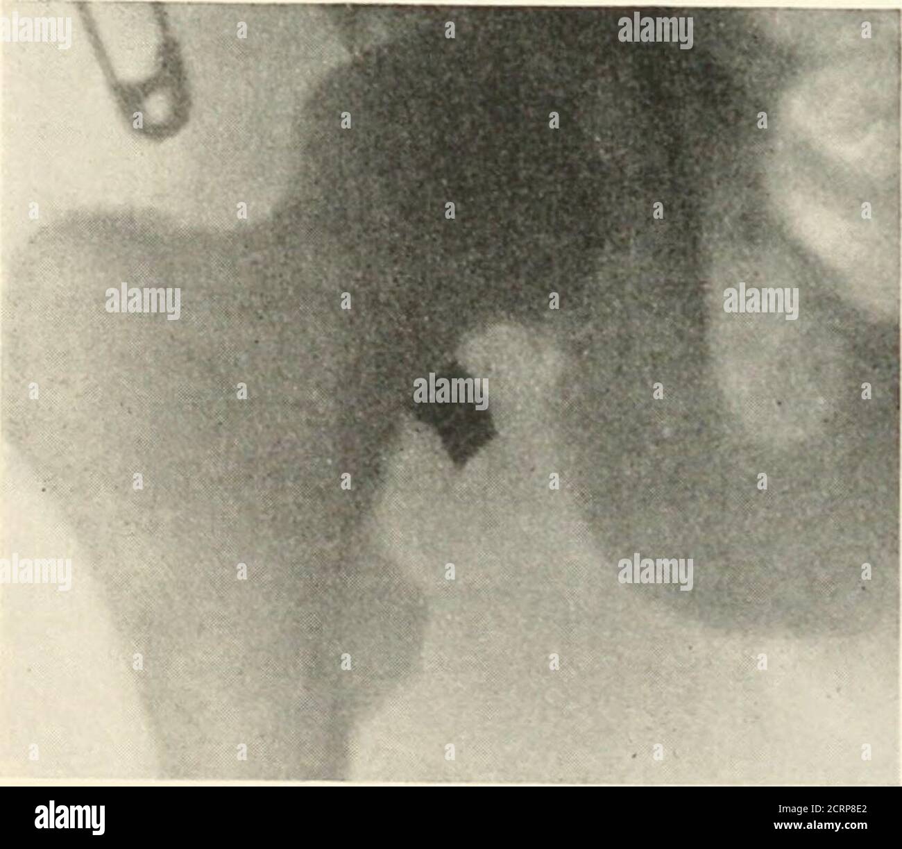 . Radiography, x-ray therapeutics and radium therapy . Fig. 98 ...