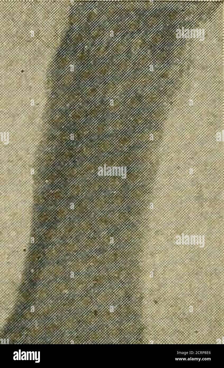 . The Roentgen rays in medicine and surgery as an aid in diagnosis and ...