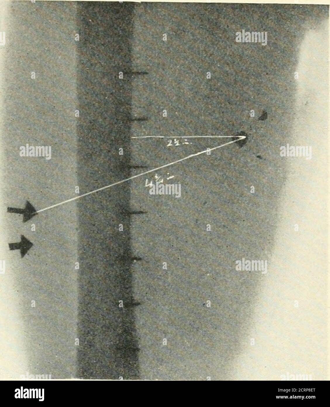 Arrow wounds hi-res stock photography and images - Alamy