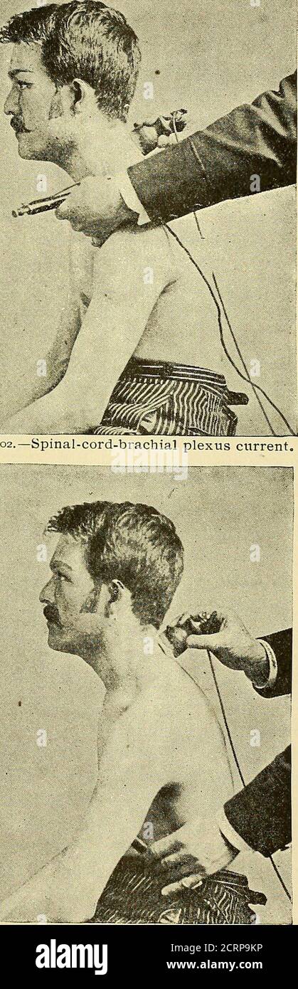 Medical oesophagus organs hi-res stock photography and images - Alamy