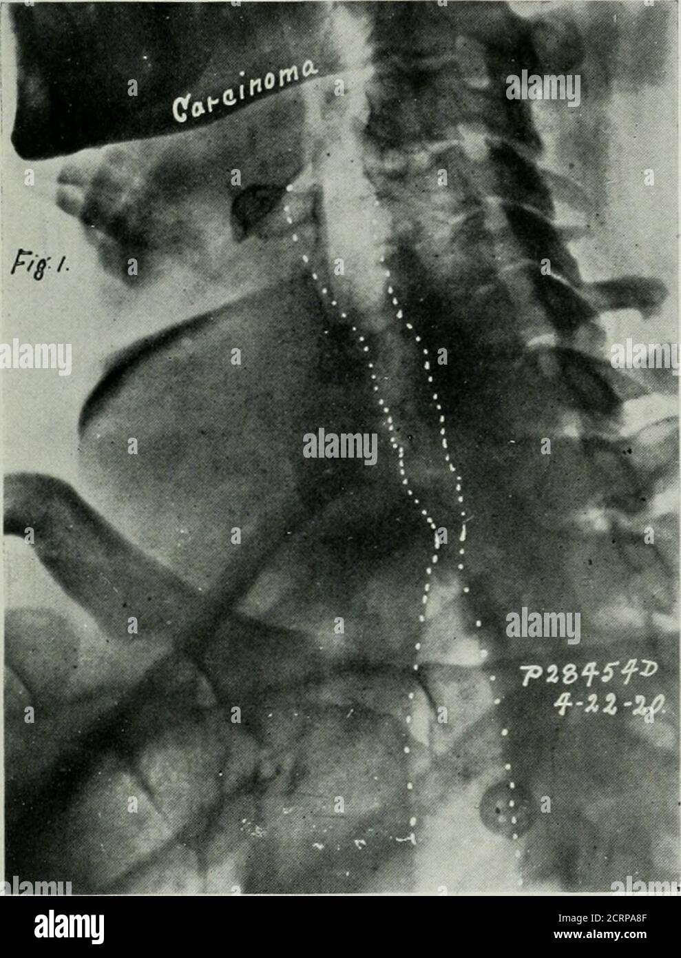 . The American journal of roentgenology, radium therapy and nuclear ...