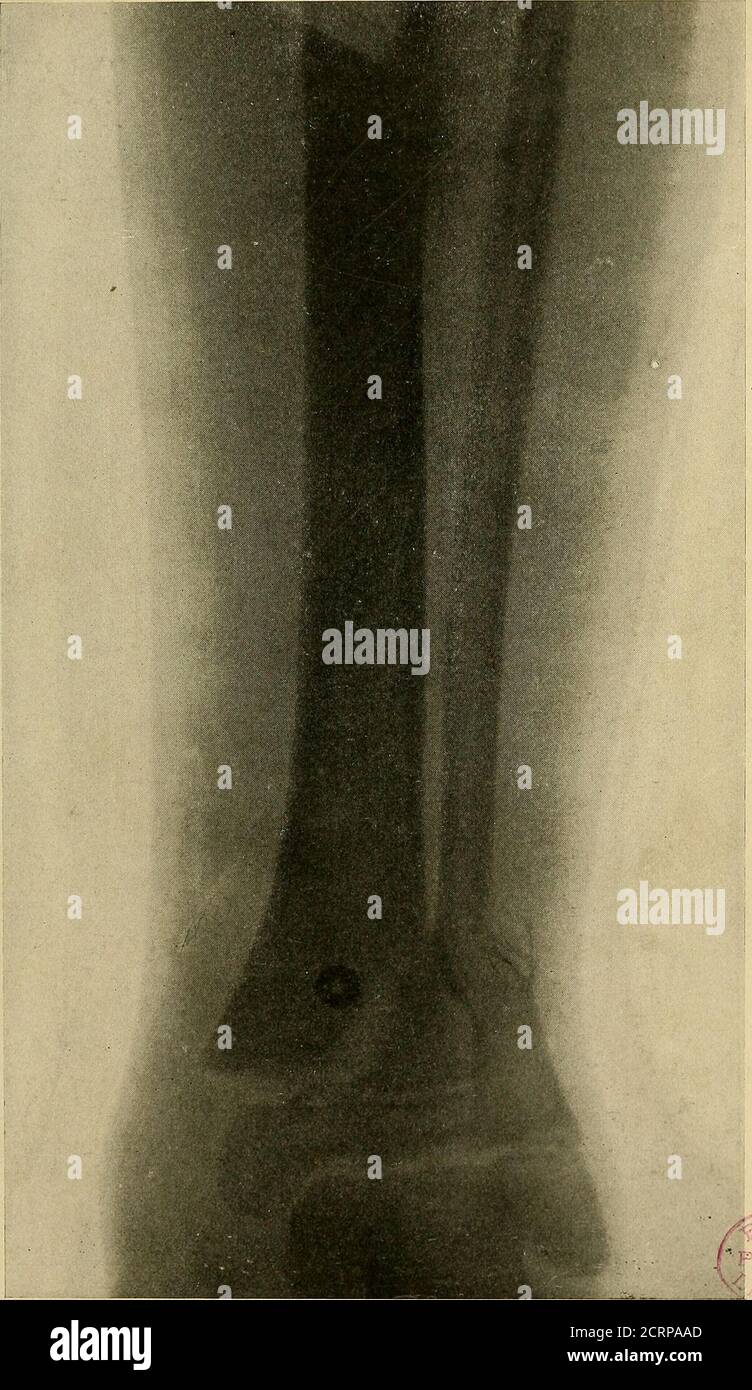 W c roentgen hi-res stock photography and images - Alamy