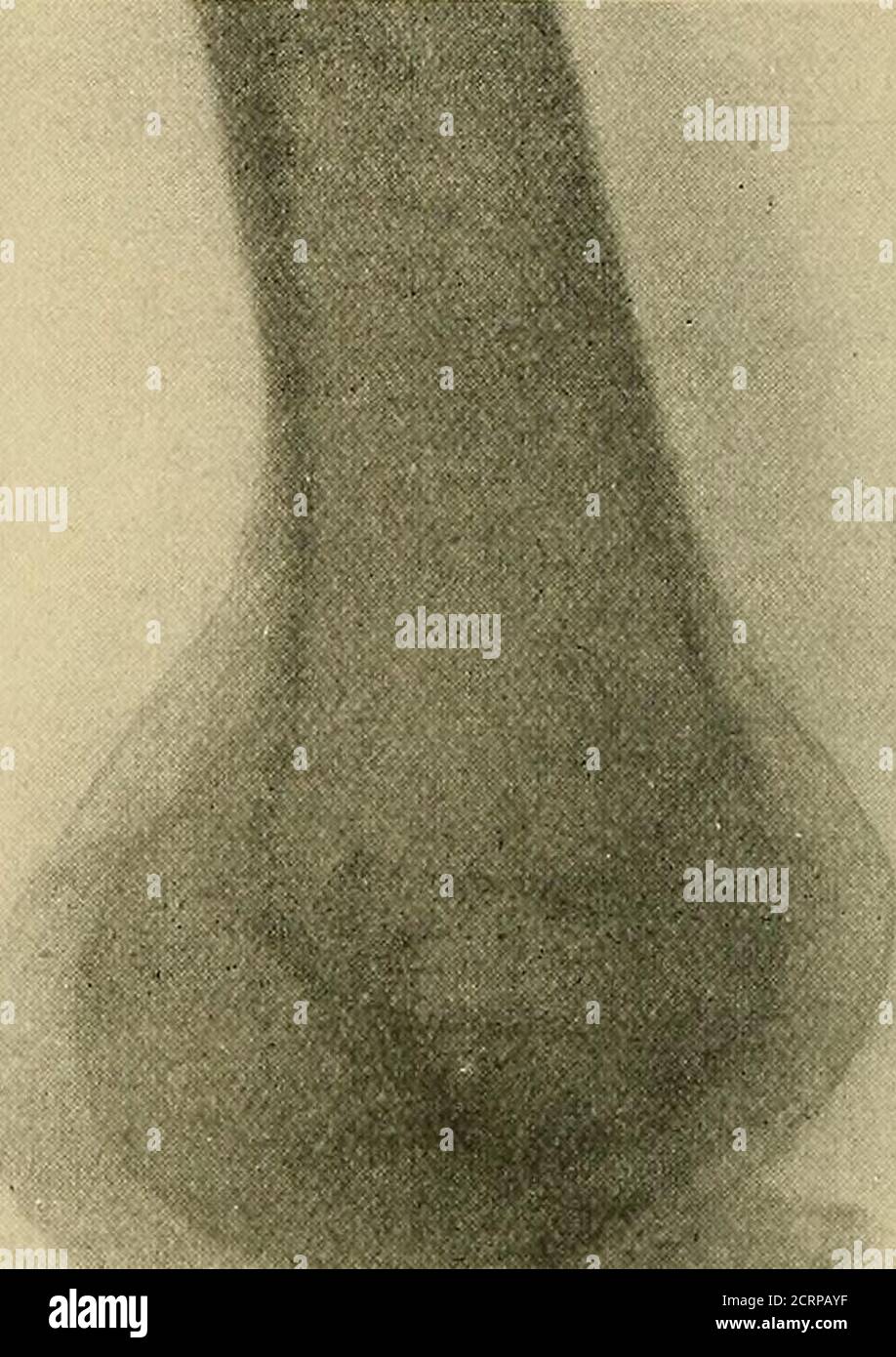 . The Röntgen rays in medical work . usion,destruction of cartilages ...