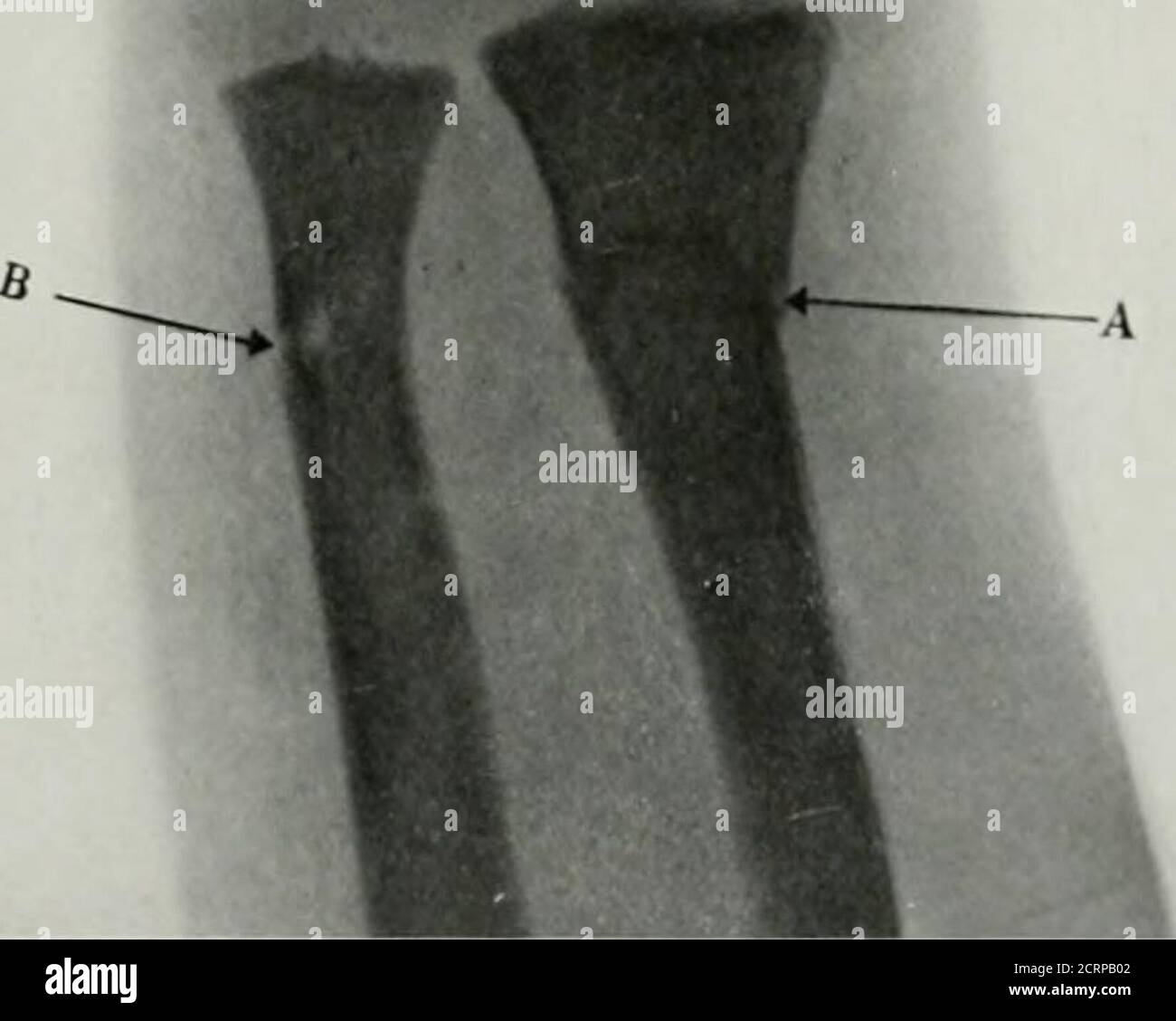 . Living anatomy and pathology; the diagnosis of diseases in early life ...