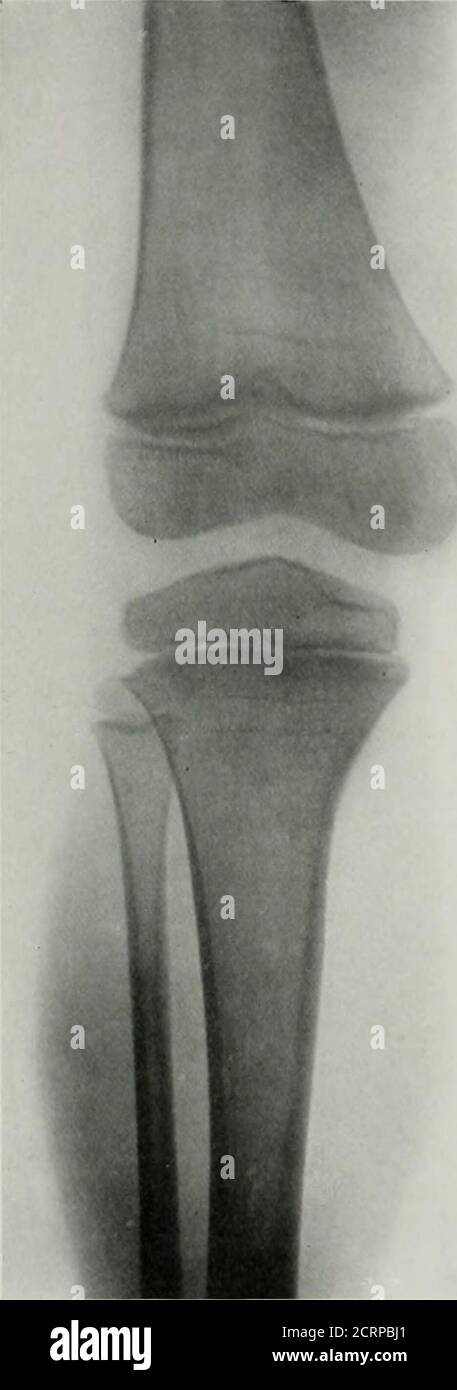 . Living anatomy and pathology; the diagnosis of diseases in early life ...