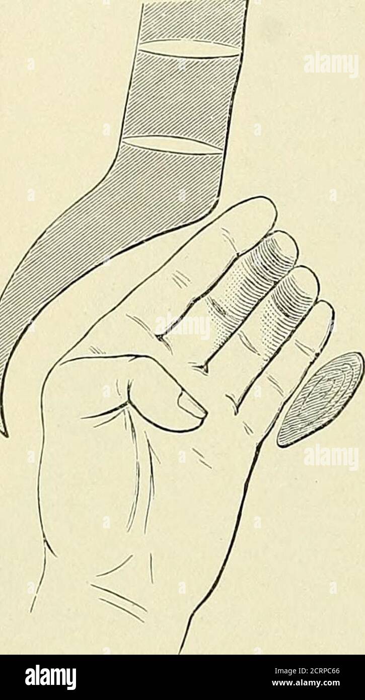 Pelvic circumference hi-res stock photography and images - Alamy