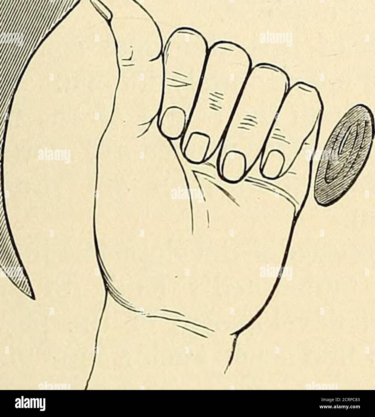 . A treatise on obstetrics for students and practitioners . Attitude ...