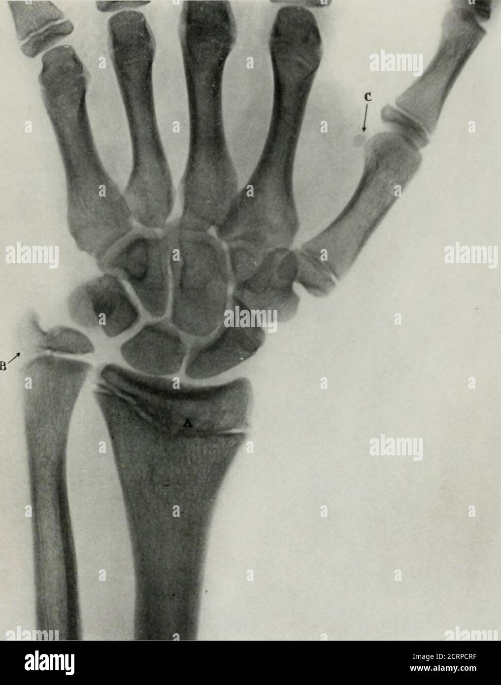 . Living anatomy and pathology; the diagnosis of diseases in early life ...