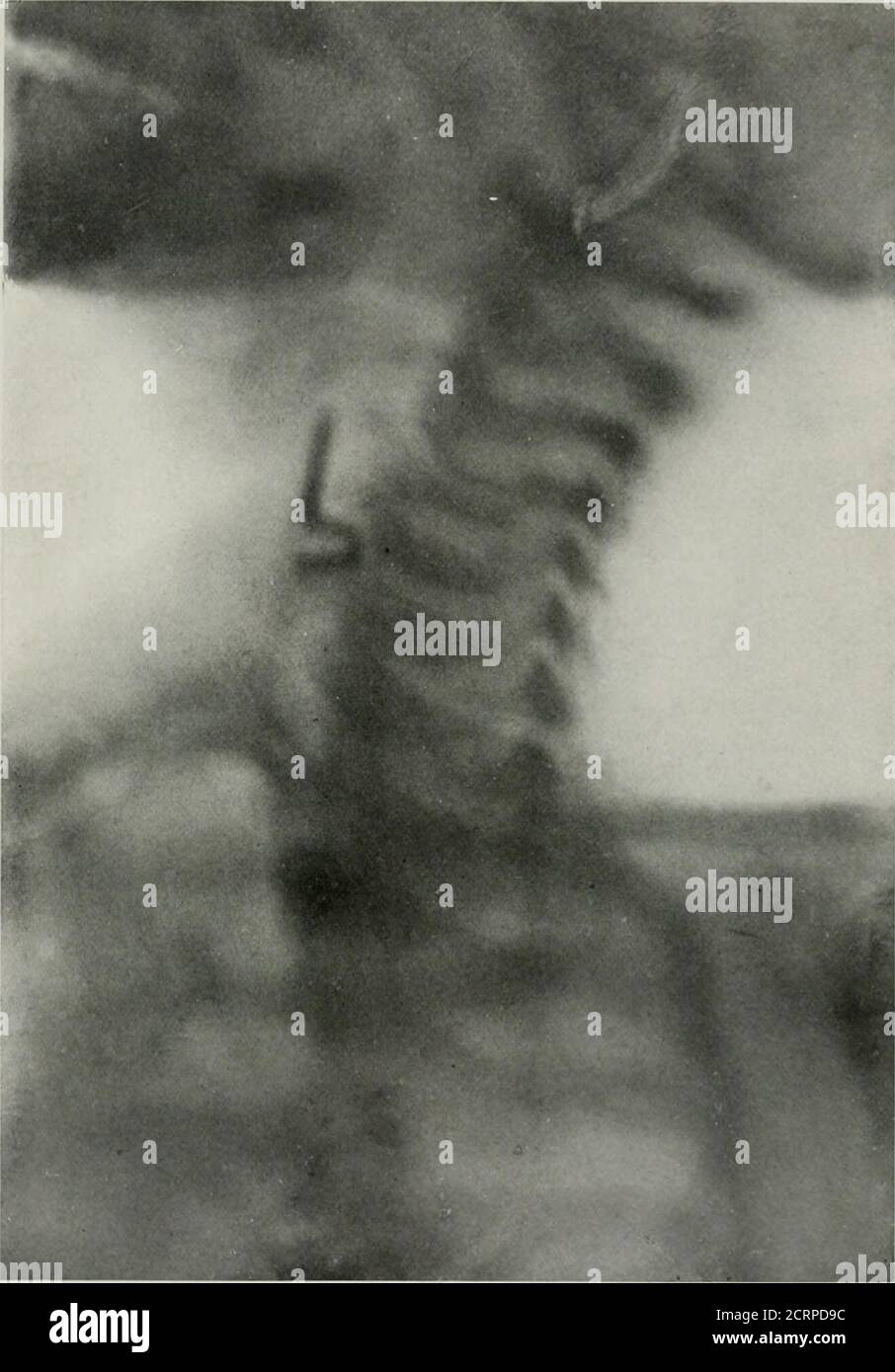 . Living anatomy and pathology; the diagnosis of diseases in early life ...