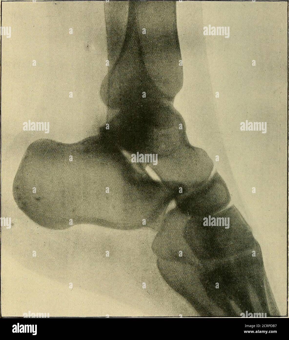 Congenital Absence High Resolution Stock Photography and Images - Alamy