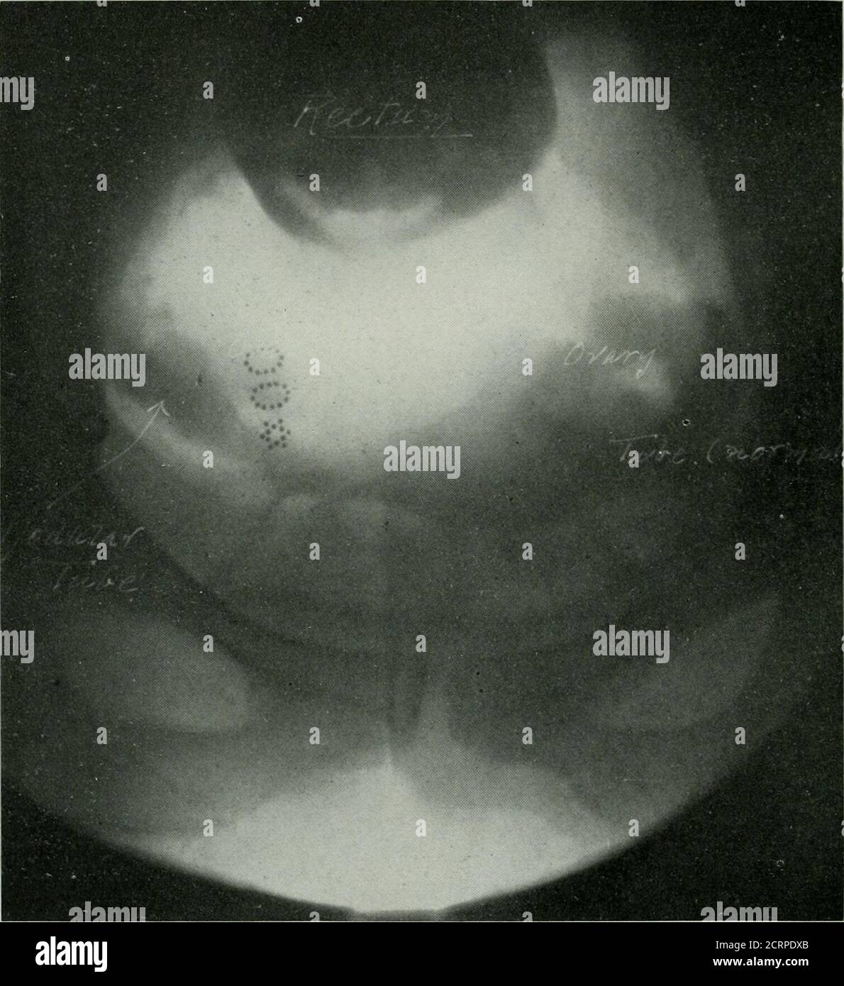 . The American journal of roentgenology, radium therapy and nuclear ...