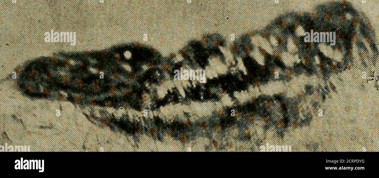 Epidermoid carcinoma hi-res stock photography and images - Alamy